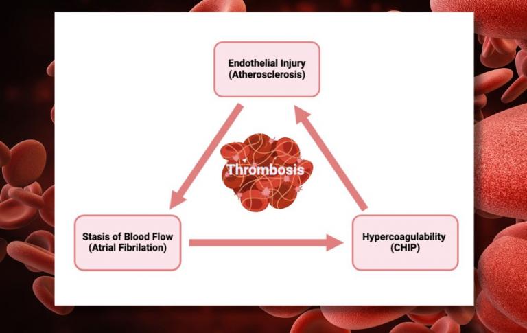 Understanding Virchow’s Triad | America's Vein Experts | Vein Care