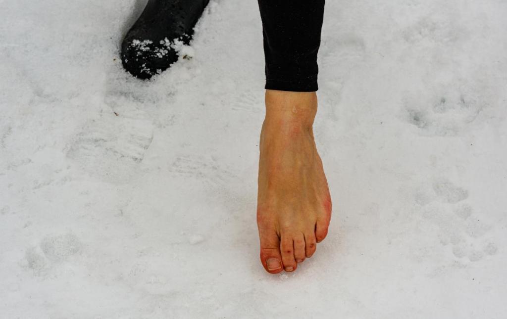 Cold Feet And Poor Leg Circulation: Causes & Early Symptoms | America's ...