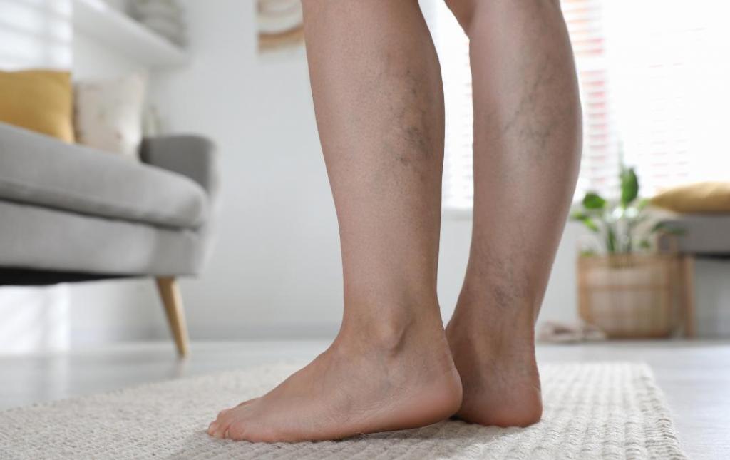 What Healthy Leg Circulation Feels Like (And What’s Not Normal ...